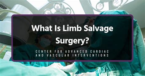 What Is Limb Salvage Surgery 2025 Cacvi
