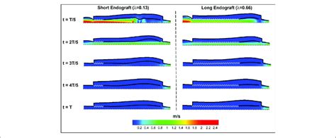 Spatial Distribution Of Fluid And Solid Behavior In The Fsi Type B
