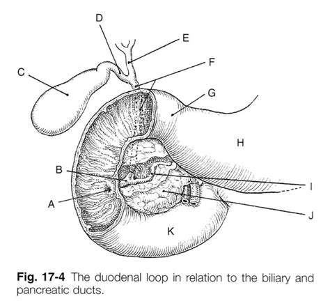 The Duodenal Loop In Relation To The Biliary And Pancreatic Ducts Diagram Quizlet