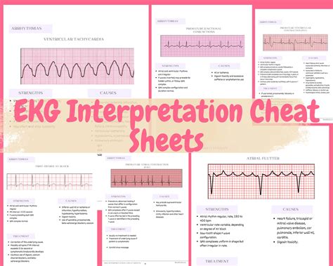 Basic Ekg Interpretation Pages Long Printable Pdf Singapore 54 Off