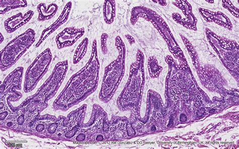 Crypts Of Lieberkuhn Duodenum