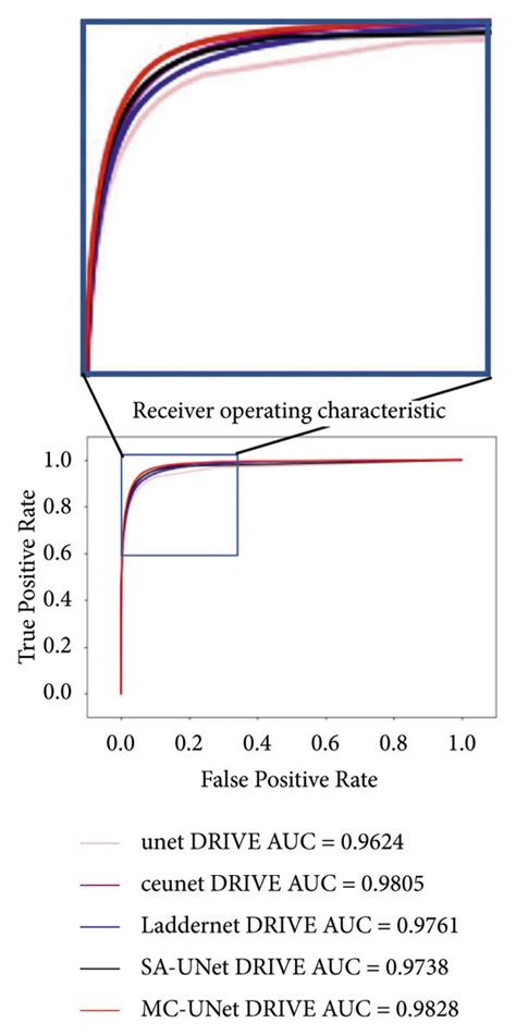 The Roc Curves Of Different Method On Drive A Stare B And
