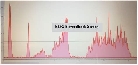 What Is Emg Biofeedback And Rtus Imaging — Laura Werner Physiotherapy