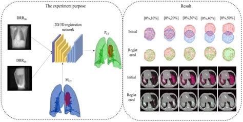2d3d Non Rigid Image Registration Via Two Orthogonal X Ray Projection