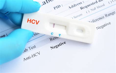 조용한 침입자 C형 간염조기 발견·적극 치료하면 완치율은↑ 간암 위험↓