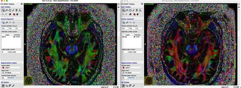Incorrect Tensors Rl Vs Ap Tractography Mrtrix3 Community