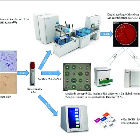 Workflow Of Eplex Bcid Panels And Standard Of Care Testing Of