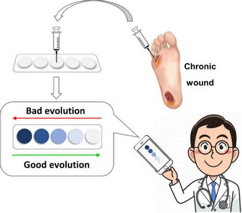 Scheme Of The Ninhydrin Based Sensor For Monitoring Chronic Human Download Scientific Diagram