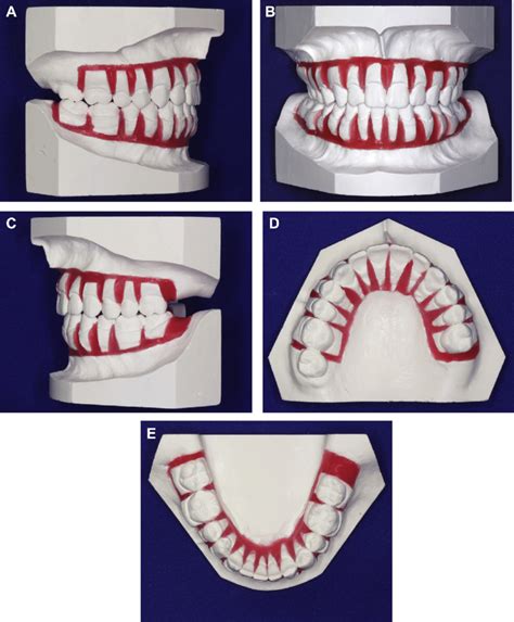 Diagnostic Setup Models Download Scientific Diagram