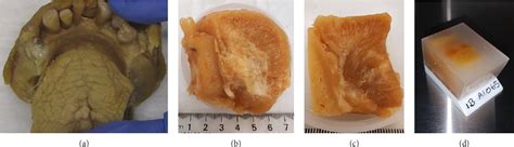 Figure From Understanding The Lingual Frenulum Histological Structure Tissue Composition