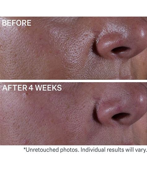 Strivectin Super Shrink Pore Minimizing Serum Macys