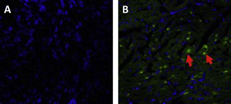 Confocal Microphotograph Of Mouse Myocardial Tissue After Utmd