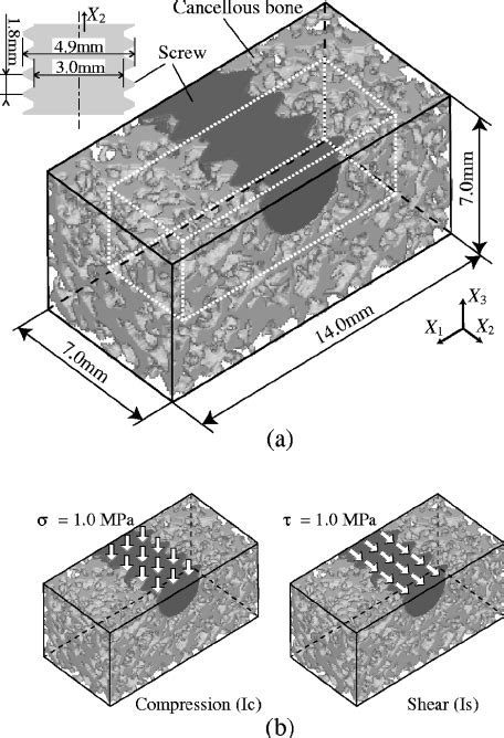Voxel Based Finite Element Model Of Cancellous Bone Adjacent To The
