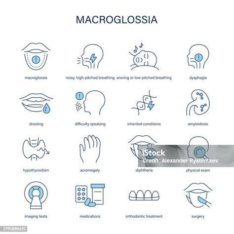 Macroglossia Symptoms Diagnostic And Treatment Vector Icon Set Stock