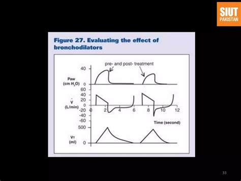 Ventilator Waveforms Pptx