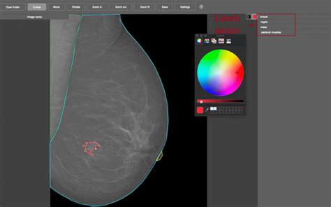 Breast Parts And Tumor Annotation Using Rectlabel Tool Download Scientific Diagram
