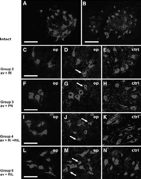 Transverse Sections Of Spinal Cord Taken From A And B An Intact C7 Download Scientific
