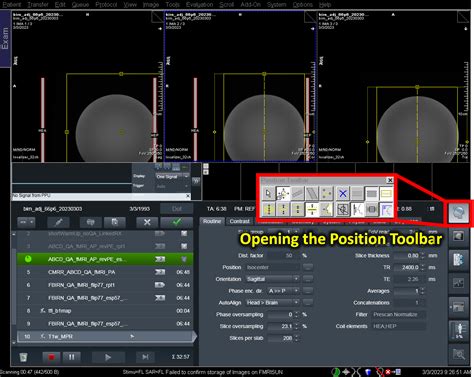 Position Toolbar Usage On The Prisma — Cfmri Siemens Prisma Documentation Documentation