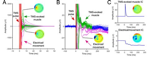 Figure 1 From Analysing Concurrent Transcranial Magnetic Stimulation And Electroencephalographic