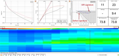 Pulsed Eddy Current For Pressure Vessel Insulation Support