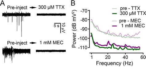 Pharmacological Suppression Of The LFP Signal A LFP Traces Before Download Scientific