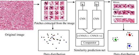 Figure 1 From A Novel Two Stage Deep Method For Mitosis Detection In