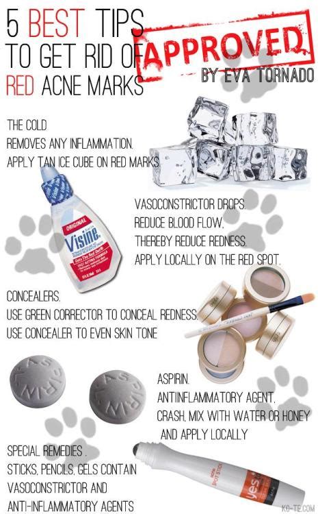 Hormonal Acne Tips 5 Best Tips To Get Rid Of Red Acne Marks All