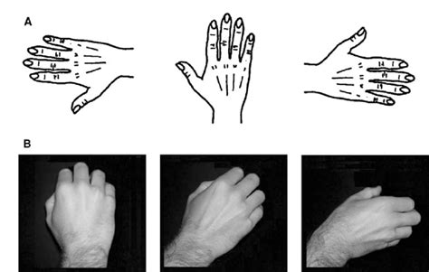 A Examples Of Stimuli Used For The Hand Laterality Task Right Hand
