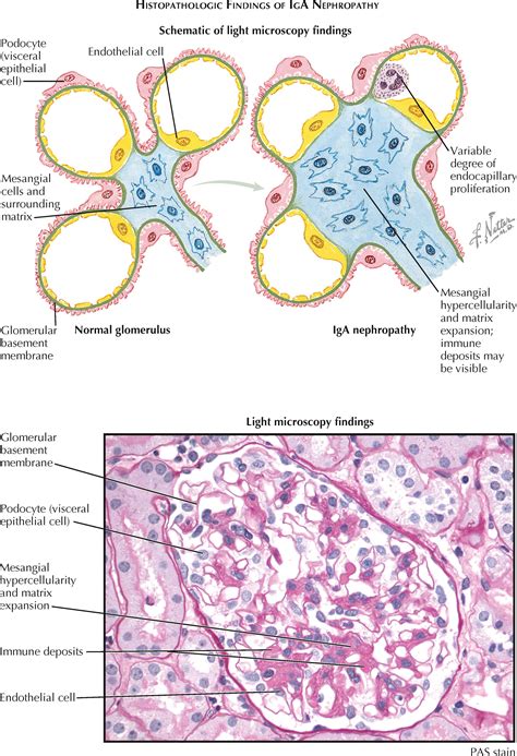Renal Diseases Clinical Tree