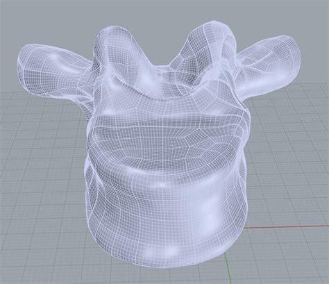 Help With A Vertebra In Rhino Boolean Difference Of Surfaces Rhino McNeel Forum