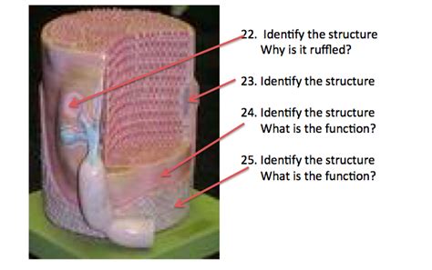 Solved Identify The Structure Why Is It Ruffled Chegg