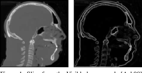 Figure 1 From Interactive Segmentation Of Volume Data Using Watershed Hierarchies Semantic Scholar