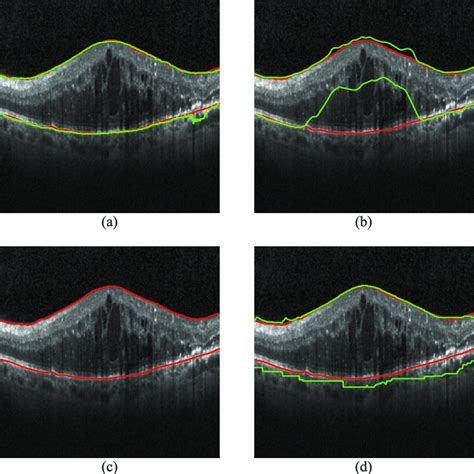 Example Of Segmentation Errors Produced By The Proposed Method A In Download Scientific