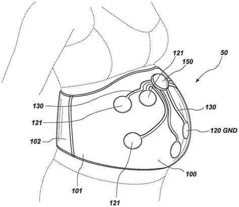 Prenatal Monitoring Device Eureka Patsnap