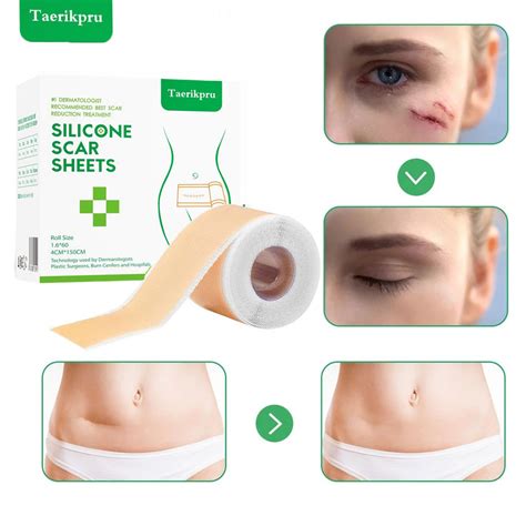 Silicone Strips Patch Silicone Scar Sheets Reusable Silicone Scar