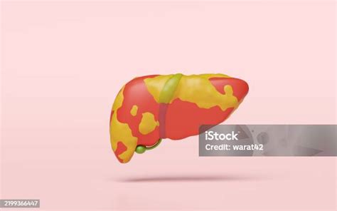 3d 지방간 질환은 분홍색 배경에 고립되어 있습니다 3d 일러스트레이션 렌더링 3차원 형태에 대한 스톡 사진 및 기타 이미지 3차원 형태 간 내부 기관 건강관리와
