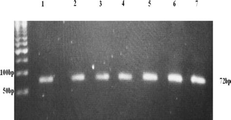 Analysis Of Heterozygous Brca1 5382ins Founder Mutation In A Cohort Of Egyptian Breast Cancer