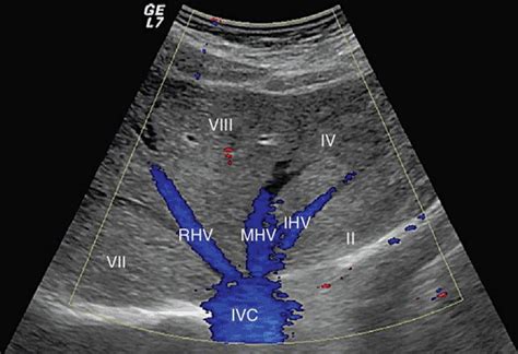 A Liver Ultrasound Is A Ali Ultrasound Clinic Facebook