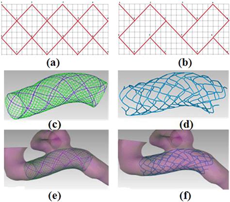 Three Dimensional Stent Model Construction A Is The Mesh Of Silk