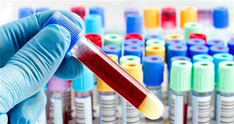 False Positives And False Negatives Definition And Examples Conceptually