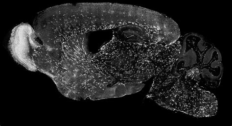 Research Images Sun Lu Lab Ut Southwestern Dallas Texas