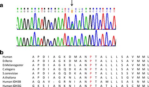 A Electropherogram Encompassing The Mutation In The Father Upper