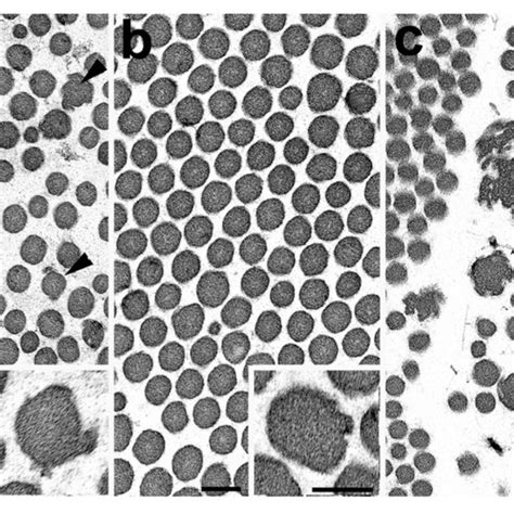 Electron Micrographs Of The Reticular Dermis Of Skin Biopsy From Download Scientific Diagram