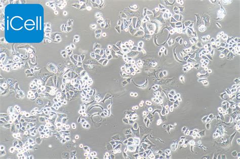 SK BR 3 人乳腺腺癌细胞 原代细胞 STR细胞 细胞培养基 镜像绮点生物