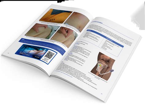 Mastering Difficult Iv Access Nysora