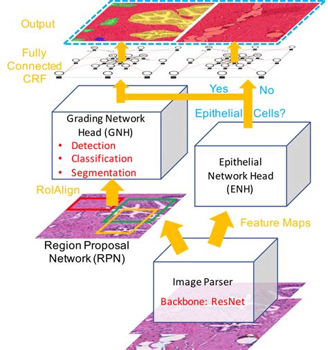 Prostate Cancer Diagnosis And Gleason Grading Of Histological Images Medical Informatics