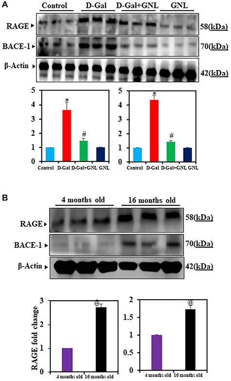 Geraniol Attenuates Oxidative Stress And Neuroinflammation Mediated
