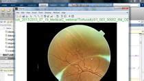 MATLAB을 활용한 영상처리 MATLAB