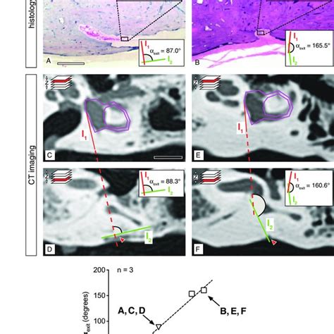 Mean Volume Of Temporal Bone Pneumatization From Birth To 18 Years Old Download Scientific Diagram