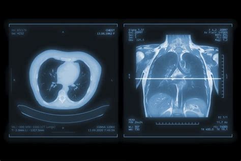 数据集：人员翻越或跨越围栏风险识别检测数据集 中猿创新 7zcode